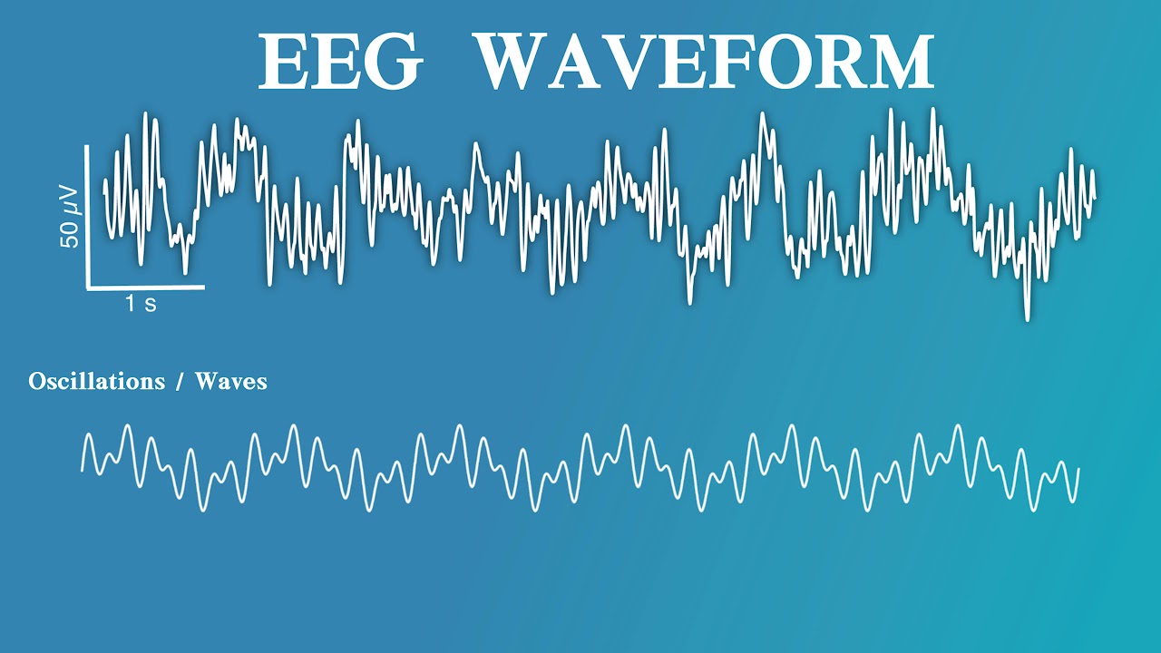 EEG for Anesthesiology - Part 2: The EEG Waveform and Spectrogram