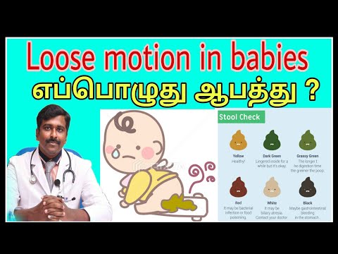 குழந்தைகளின் வயிற்றுப் போக்கு வீட்டில் செய்யவேண்டியவை | Loose motion in babies| Tamil |Dr Sudhakar |