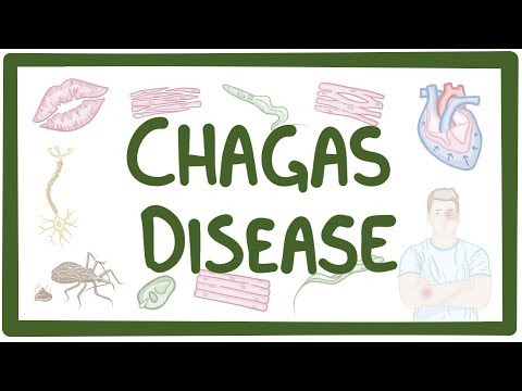 Chagas disease – causes, symptoms, diagnosis, treatment, pathology ...