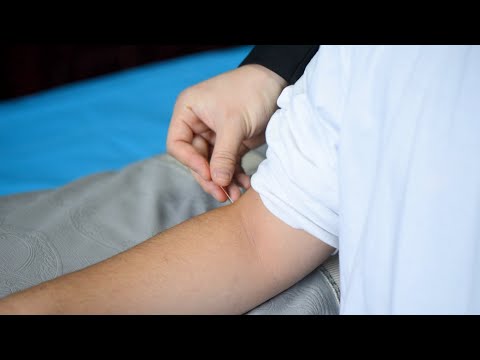 GLOBALink | Hands-on acupuncture in Traditional Chinese Medicine