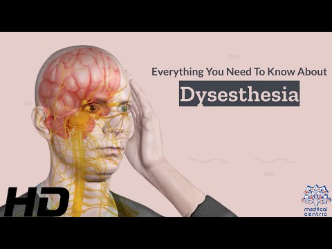 Dysesthesia 101: A Comprehensive Guide to this Mysterious Condition