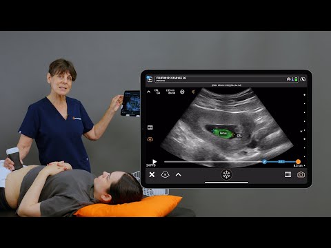 OB AI for Crown Rump Length (CRL)