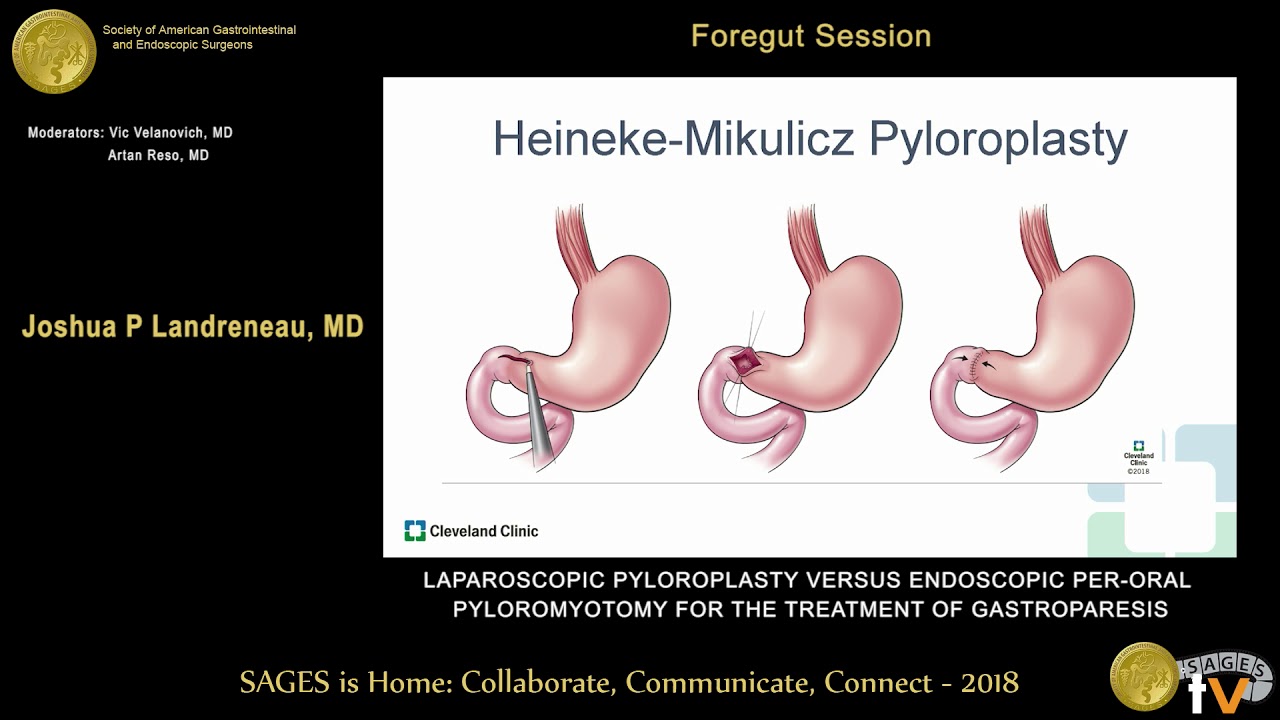 Laparoscopic pyloroplasty vs endoscopic POP for the treatment of gastroparesis