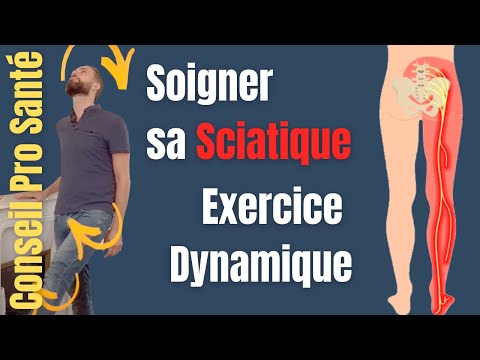 Exercice sciatique : Soulager la douleur du nerf sciatique