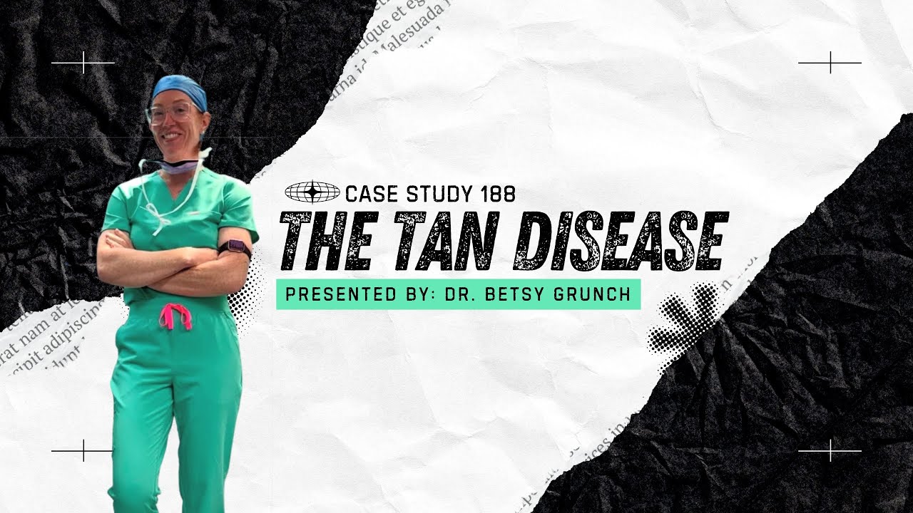 Case Study 188: Addison’s Disease | Primary Adrenal Insufficiency | Dr. Betsy Grunch explains