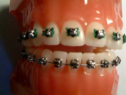 Brackets de Hello Kitty - Imagui