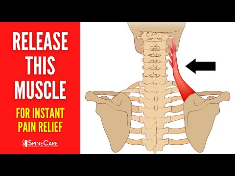 The #1 Muscle to Release to Fix Your Neck Pain