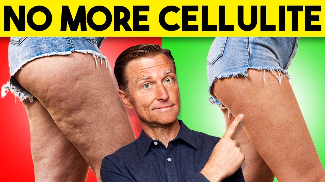 The FASTEST Way to Lose Cellulite