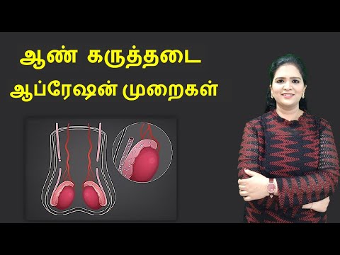Vasectomy - Male Sterilization | Tamil