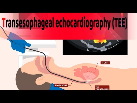 Transesophageal echocardiography TEE is a heart test understand what how & when its doctors use