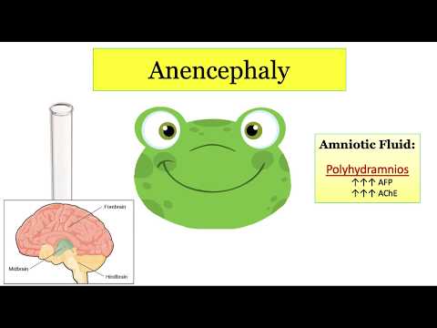12DaysinMarch, Congenital Neuro Abnormalities Part 1 for the USMLE Step One Exam