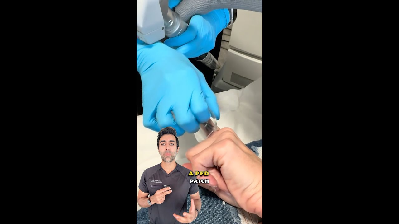 This Patch Speeds Up Laser Tattoo Removal