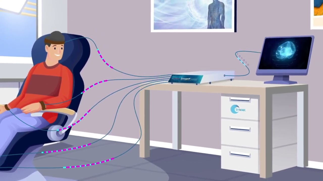 imaet PRO animation