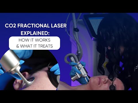 CO2 Fractional Laser Explained: How It Works & What It Treats