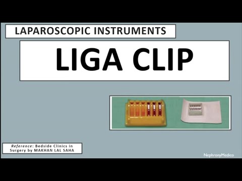 Ligating Clip - Surgical Clip Latest Price, Manufacturers & Suppliers