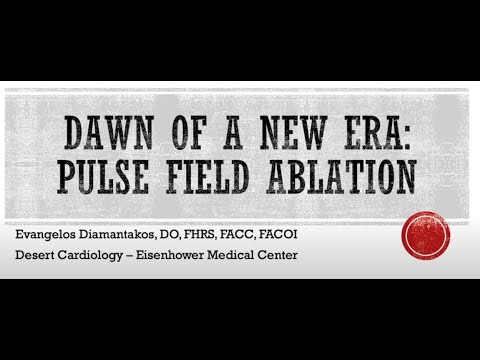 Pulse Field Ablation (PFA) for AFib