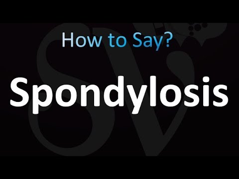 How to Pronounce Spondylosis (correctly!)