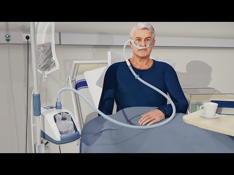 High Flow Nasal Cannula Machine - HFNC Oxygen Therapy Machine Latest ...