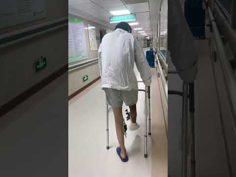 Non weight bearing Walk with walker Tibial external fixator