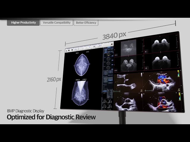 Diagnostic Monitor - 19-Inch 1.3mp Clinical Review Monitor LG Service ...