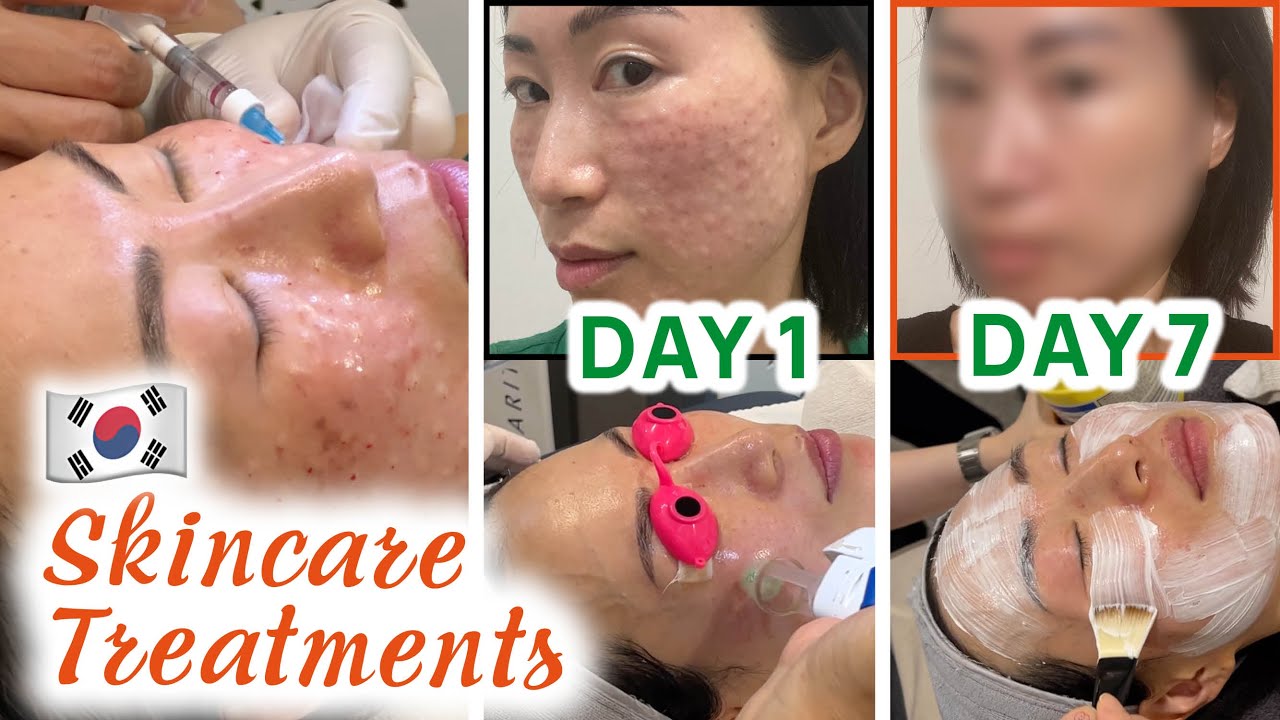 Over 40, 4 Skincare Treatments in 1 Day in Korea! Laser Lifting, PDRN Skin Booster & More