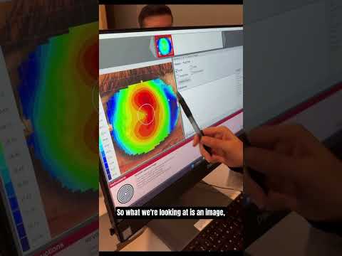 Understanding Corneal Topography