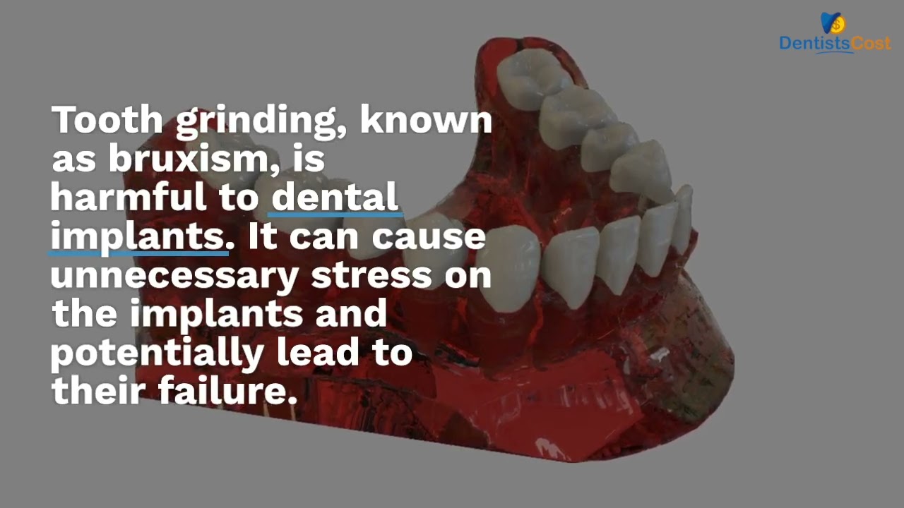 Bad Habits You Should Prevent After Getting Dental Implants