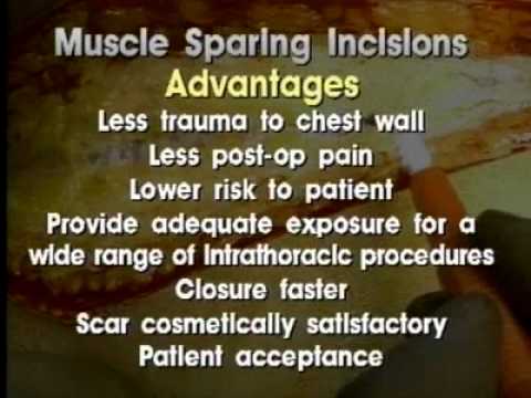 Thoracic incision