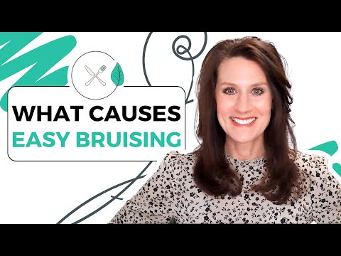 What Causes Easy Bruising? Nutrition Causes & Tips