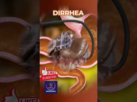 Diarrhea Formation: Causes, Mechanism, and Prevention Explained