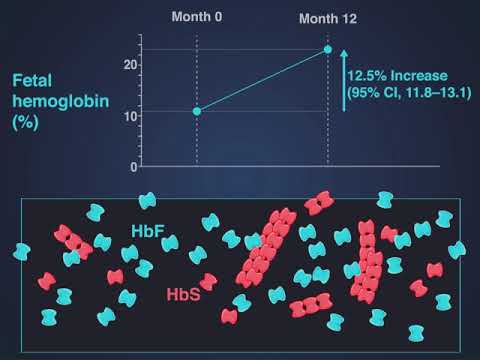 Hydroxyurea Capsules - Myelostat Latest Price, Manufacturers & Suppliers