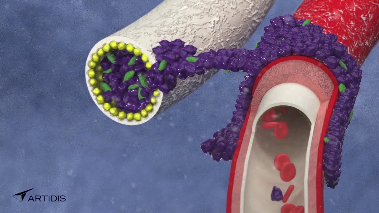 Artidis | Automated and reliable tissue diagnostics