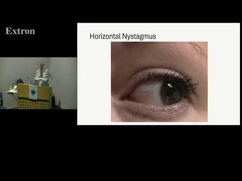 Acute Dizziness - is it ever an ENT Emergency?
