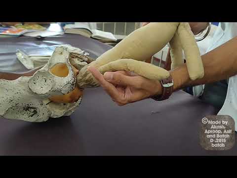 Assisted breech delivery | Burns Marshall method | mauriceau smellie veit technique |