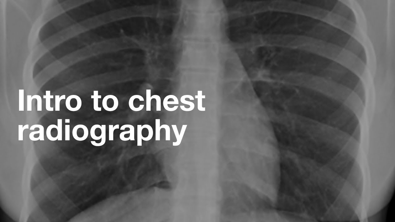 Introduction to Chest Radiography