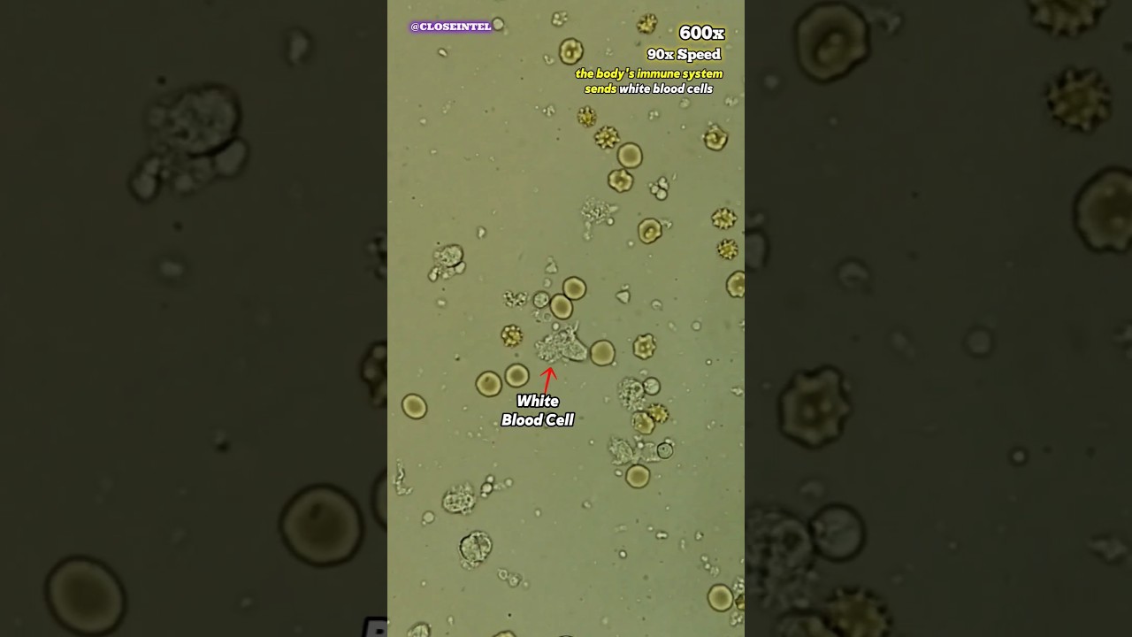 Pimple Under A Microscope