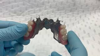 Chrome Dentures | 45+ Years Experience | Metal Partials