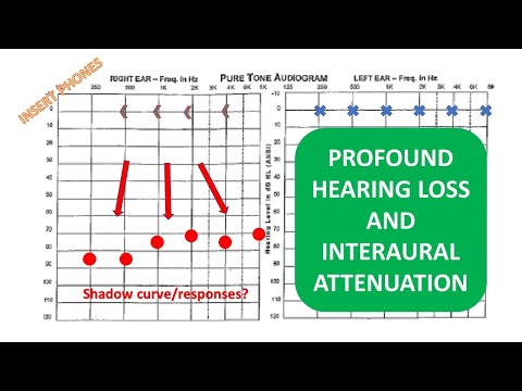 Chapter 5: Interaural Attenuation Videos – The Masking Handbook (For ...