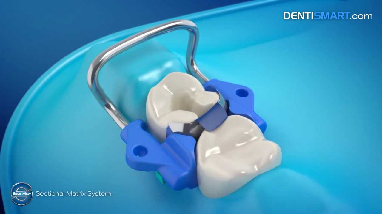 SmartView Sectional Matrix System - Product Video