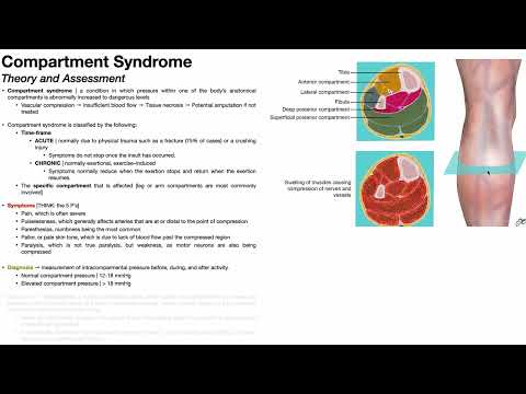 Compartment Syndrome Overview 💪 Presentation, Diagnosis, & Treatment