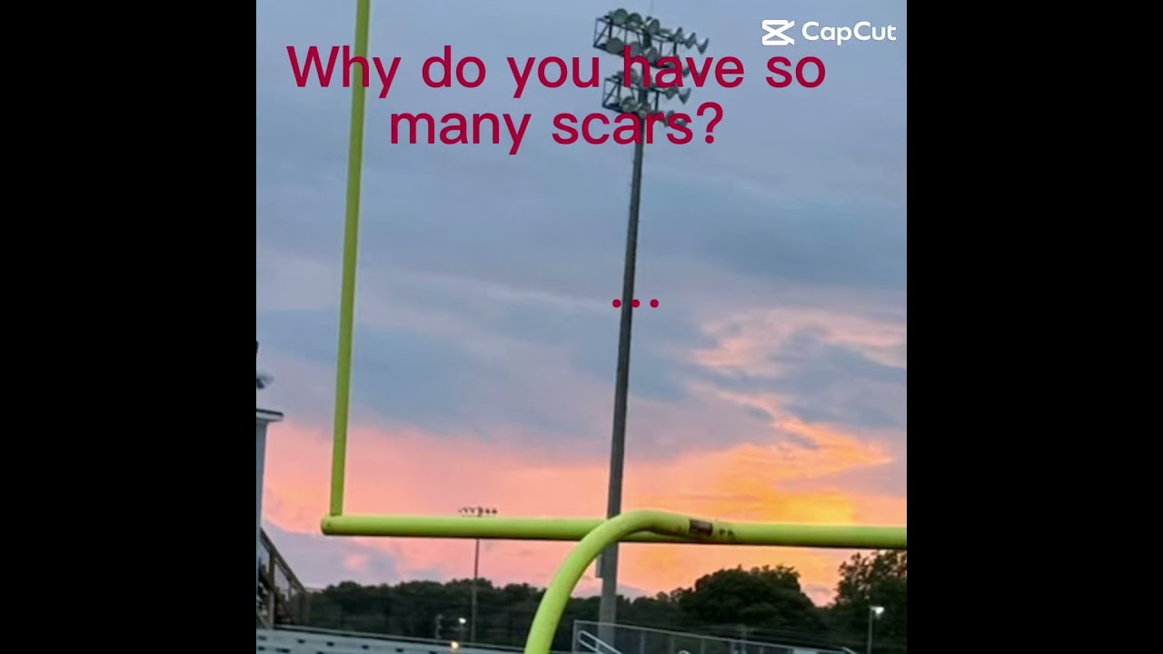 I’m just a BIT clumsy…