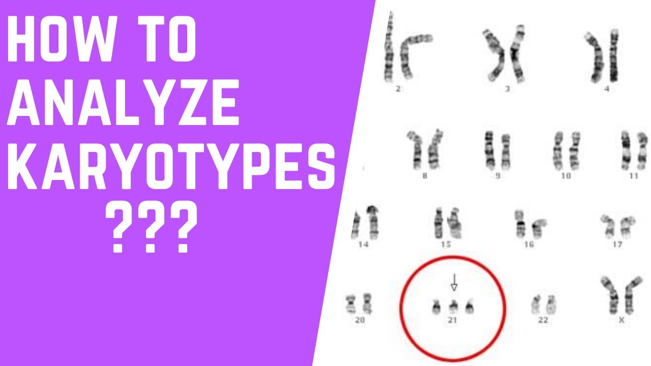 How to Analyze Karyotypes 101
