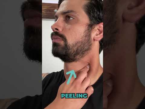 The BEST Self Massage Routine For The Sternocleidomastoid