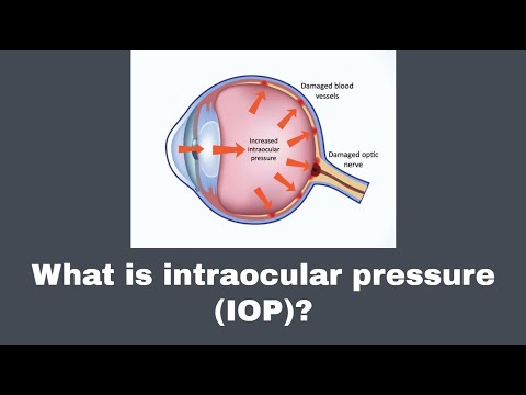 What is intraocular pressure (IOP) ?