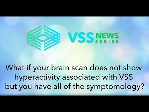 Brain scan does not show hyperactivity associated with VSS but you have all of the symptomology?