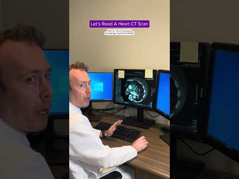 How to read a coronary CT scan #shorts #hearthealth #heartdisease
