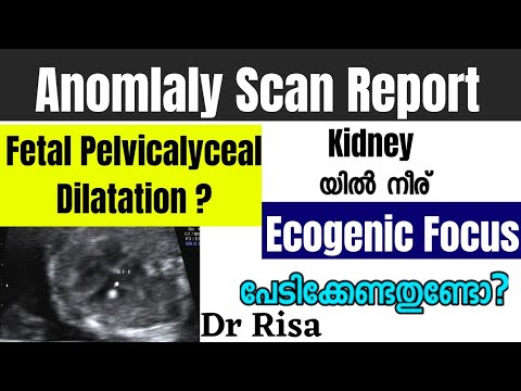 Abnormalities in Fetal Scan Report Malayalam | Fetal Pelvicalyceal Dilatation| EIF