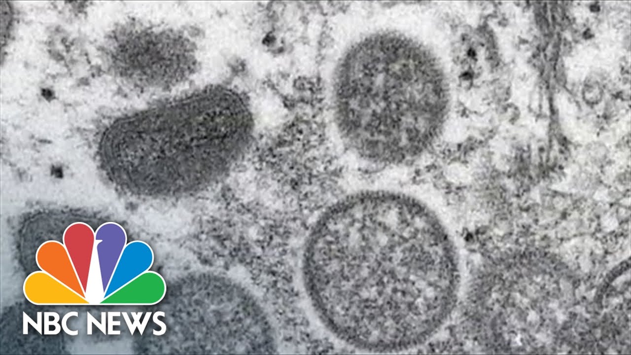 WHO Declares Monkeypox A Global Health Emergency As Cases Skyrocket