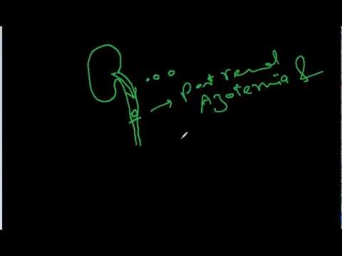 Renal Colic Basics