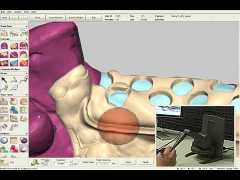 Introduction to the SensAble Dental Lab System
